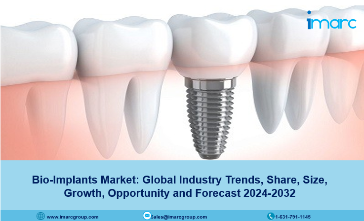 Bio-Implants Market Demand, Growth, Industry Trends 2024-2032 : Trusted ...
